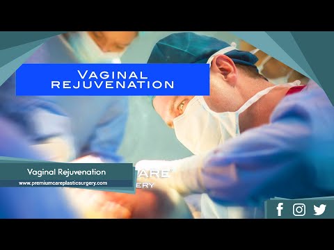 Vaginal Rejuvenation with Labiaplasty, Clitoral Hood Reduction, and Fat ...