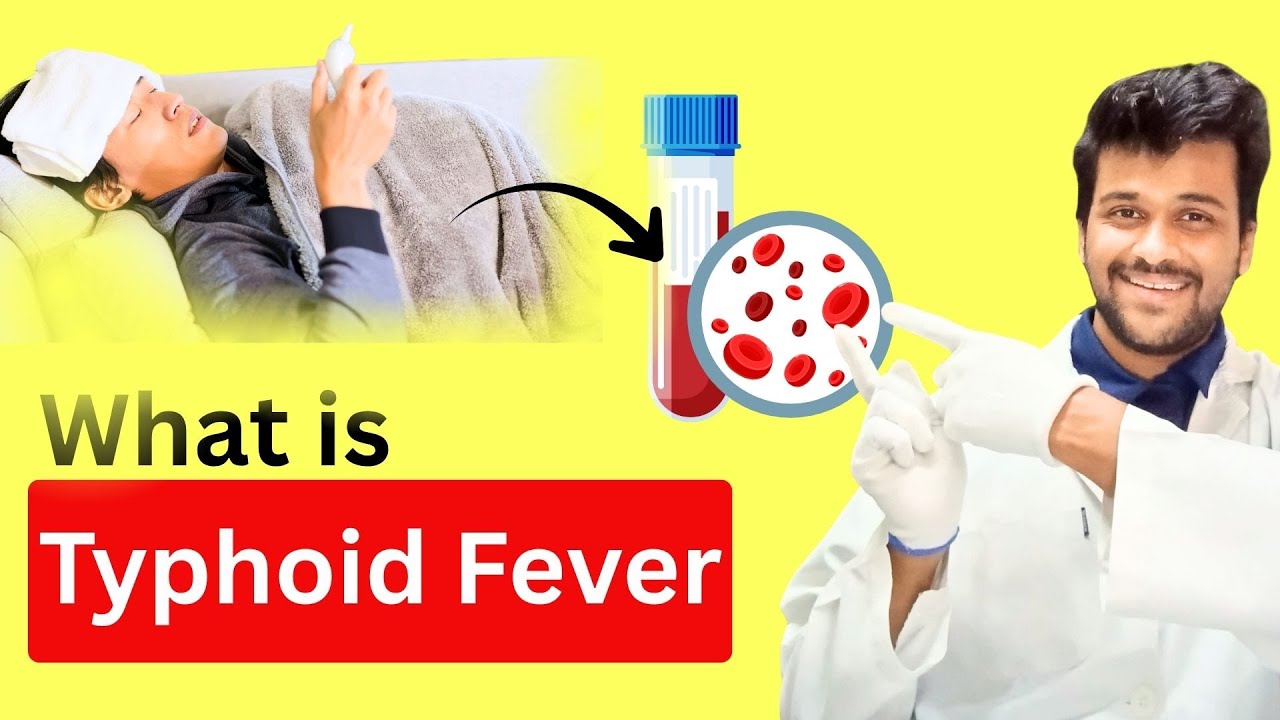 Typhoid Fever - Fever rising in the evening, rashes on skin | Symptoms ...