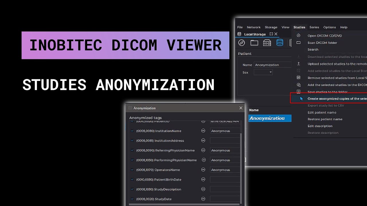 Studies anonymization with Inobitec DICOM Viewer - YouTube