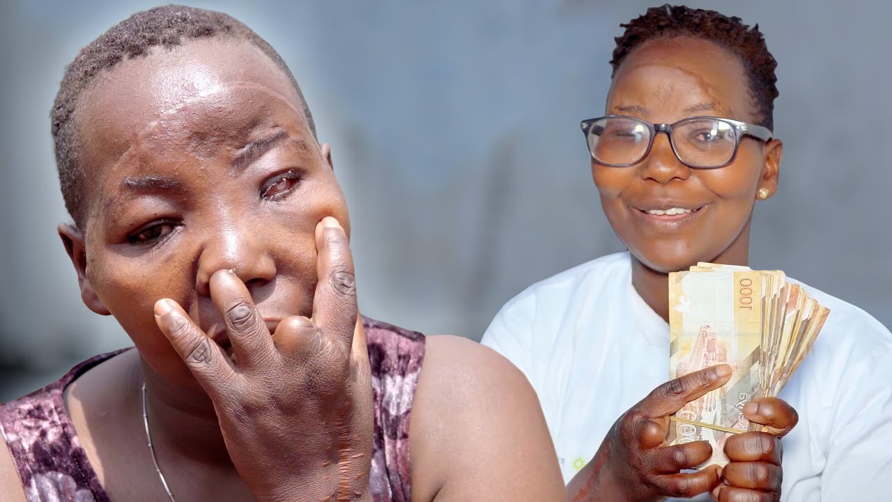 Her Husband Plucked Off Her Eye and Fingers, Year Later He Regretted It ...