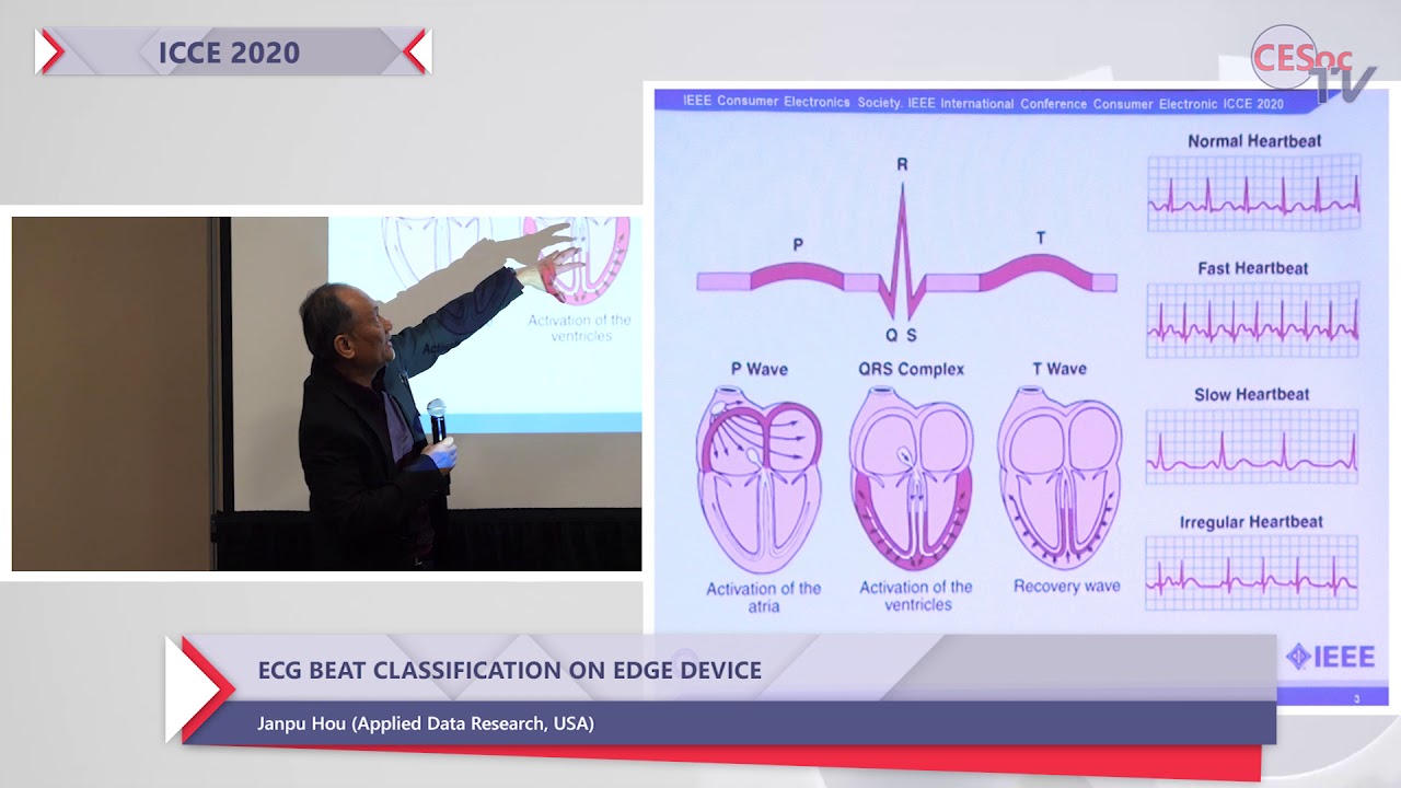ECG Beat Classification on Edge Device - YouTube