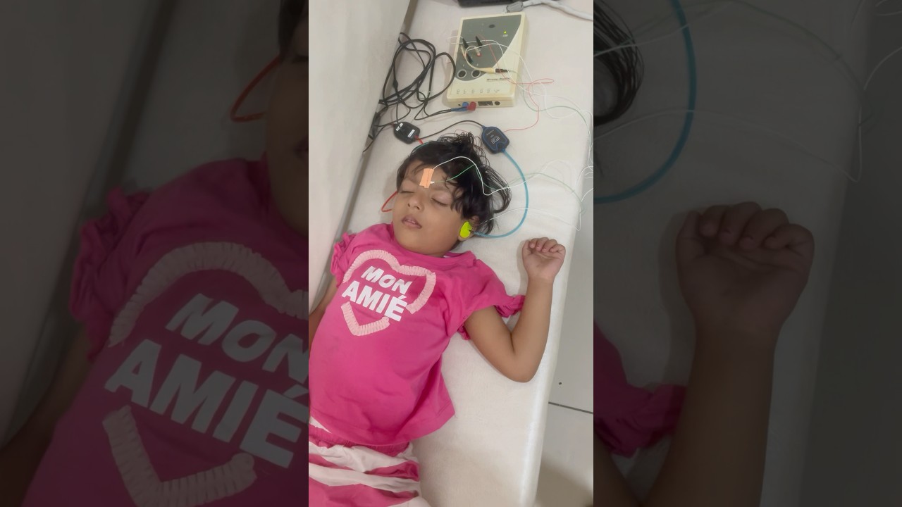 Brainstem Evolved Response Audiometry # Bera test 3 years children 🧒 # ...
