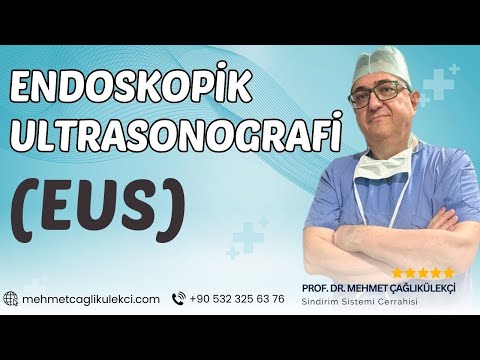 Endoskopik Ultrasonografi(EUS) | Prof. Dr. Mehmet Çağlıkülekçi - Gastroenteroloji Cerrahisi