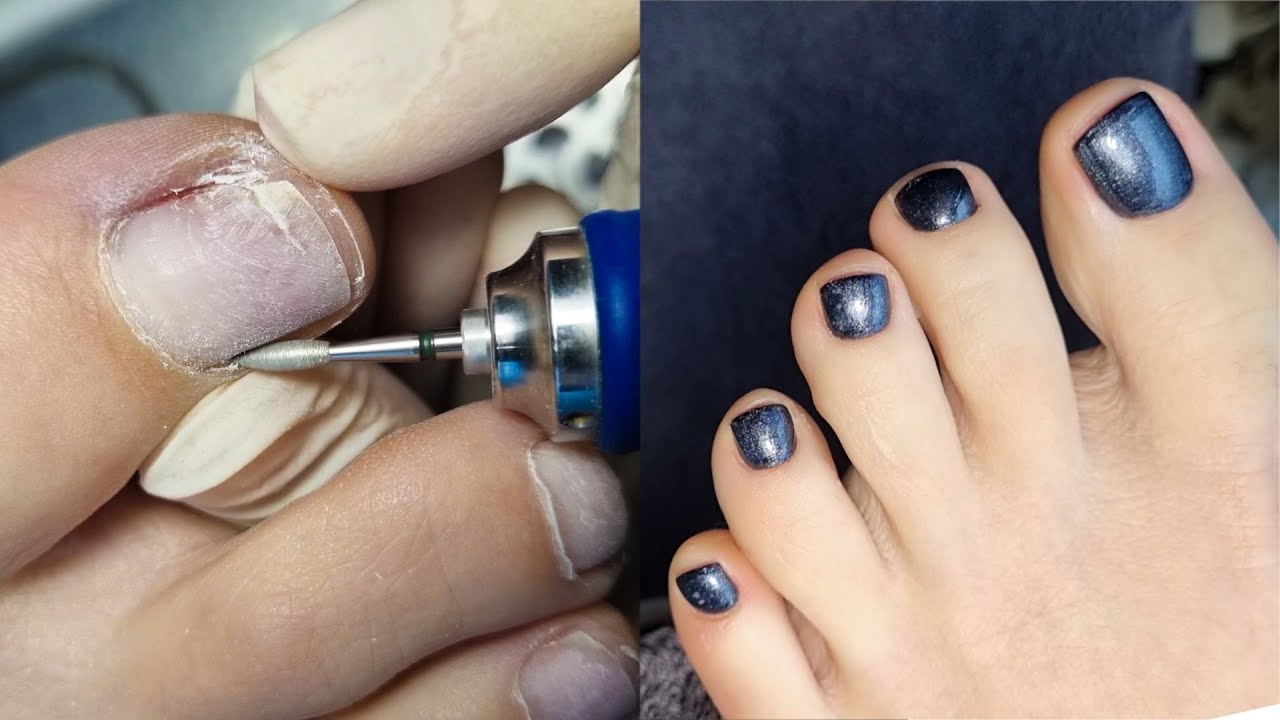 Manicure Transformation 💅 Pedicure Transformation 👣 - YouTube