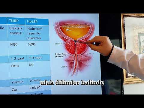 En İyi Prostat Ameliyatı Hangisi? REZUM mu? HOLEP mi? TUR-P mi?
