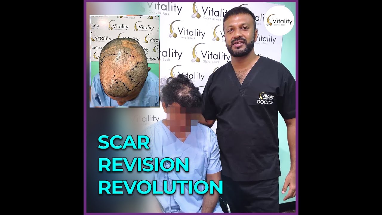 Sri Lanka's First DHI Procedure for Plastic Surgery Scars! - YouTube