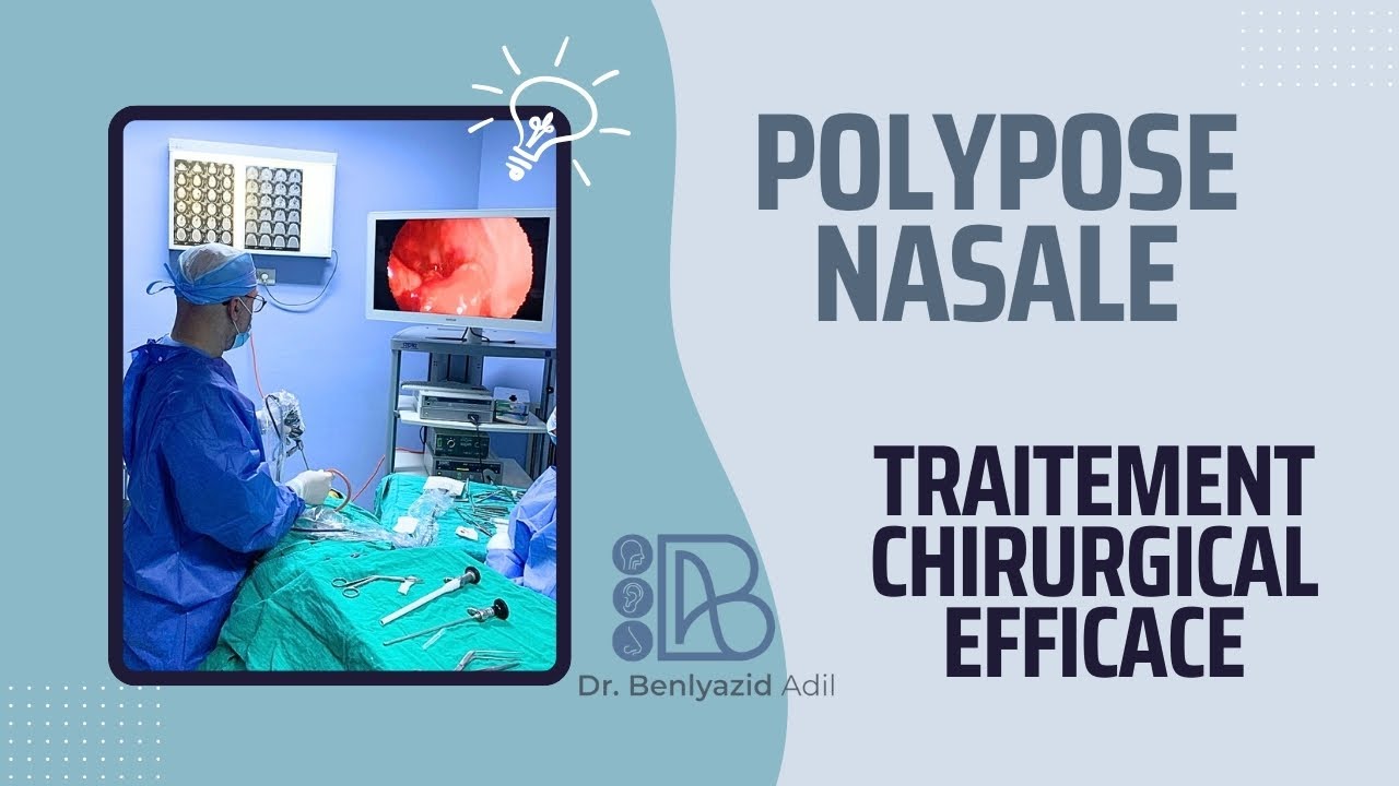 Polypose Nasale : Traitement Chirurgical Efficace - YouTube