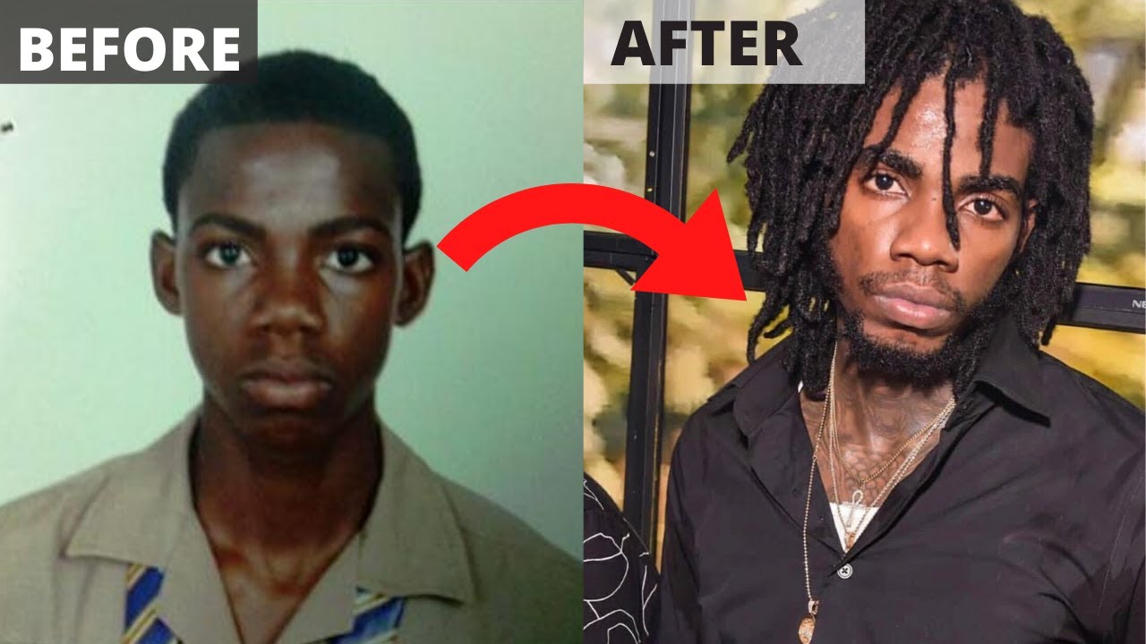 Alkaline Before And After