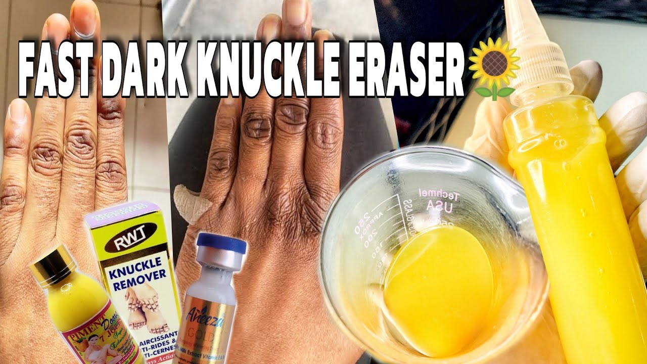 HOW TO MIX THE MOST EFFECTIVE KNUCKLE THERAPY OIL🌻| KNUCKLE ...