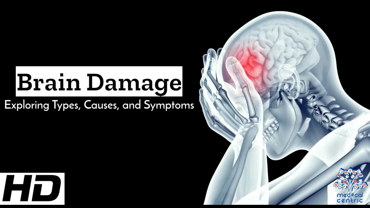 Brain Damage Decoded: Breaking Down Types, Causes, and Symptoms - YouTube