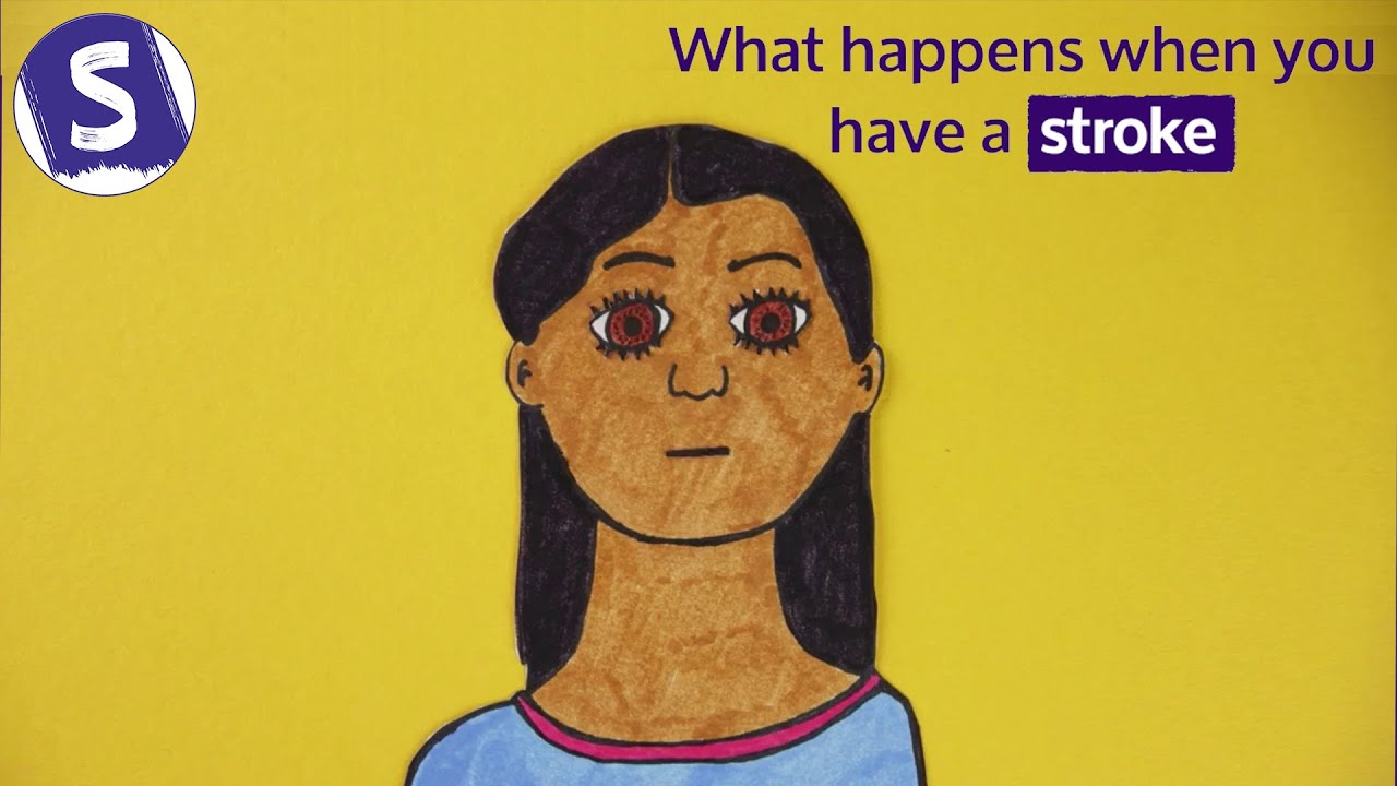 What happens when you have a stroke - Childhood Stroke Project - YouTube