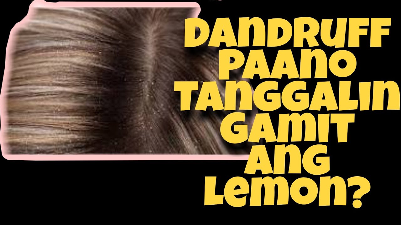 How To Remove Dandruff Using Lemon? - YouTube