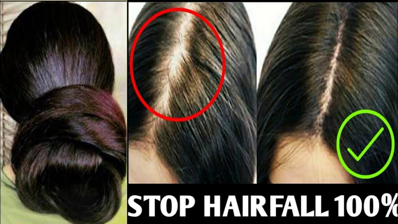 How To Control Hair Fall And Regrowth Hairs | Hair Fall Solution At ...