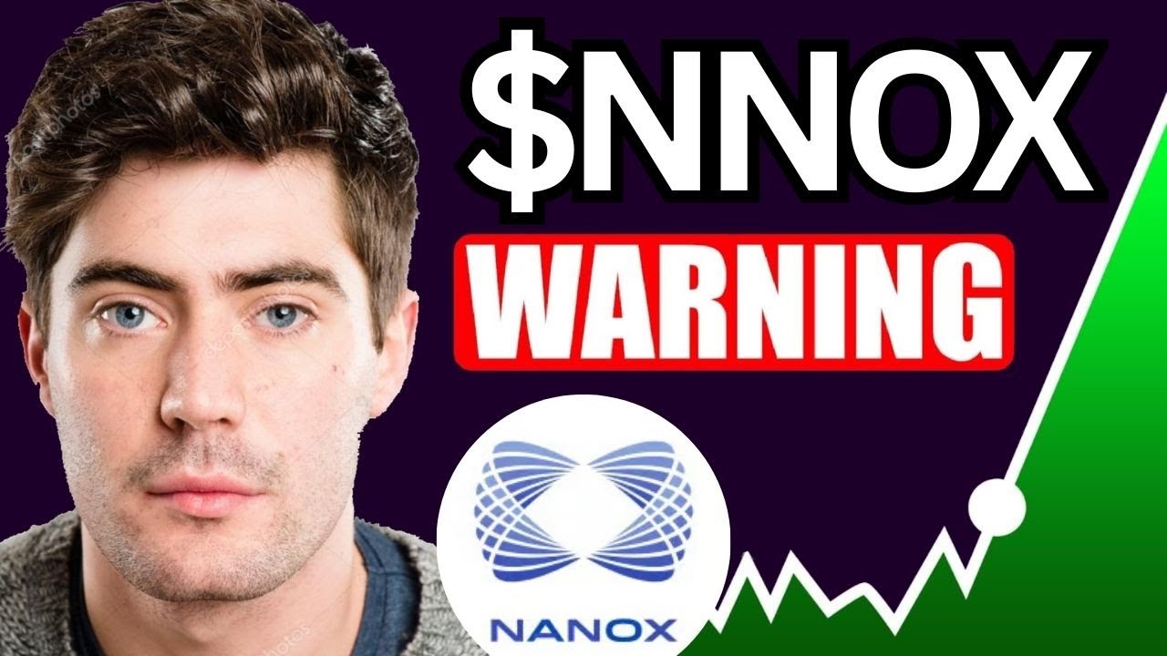NNOX Stock MASSIVE NEWS!? (Thank Me Later Bro) Nano X Imaging stock ...