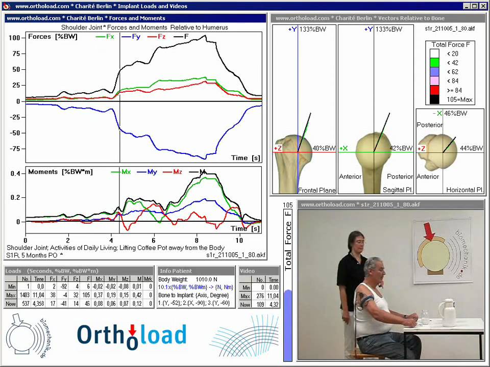 Loads Acting in the Shoulder Joint. Activity of Daily Living - YouTube