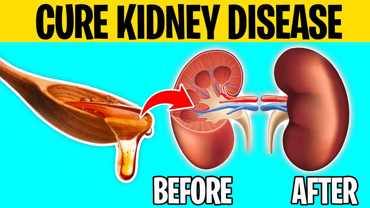 No KIDNEY Patient Will Ever Lose a Kidney Again, Watch This - YouTube