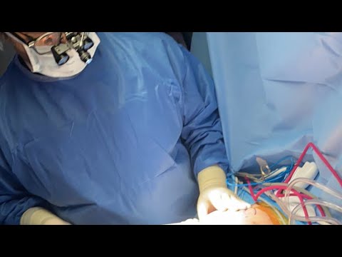 Daddy makeover Gynecomastia surgery Dr Jeneby Plastic Surgery In San ...