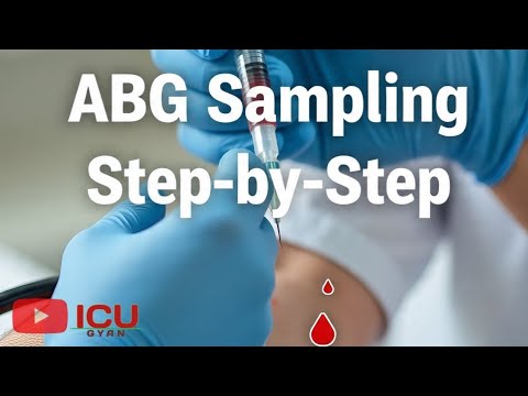 ABG sampling- How & when do it when not - YouTube