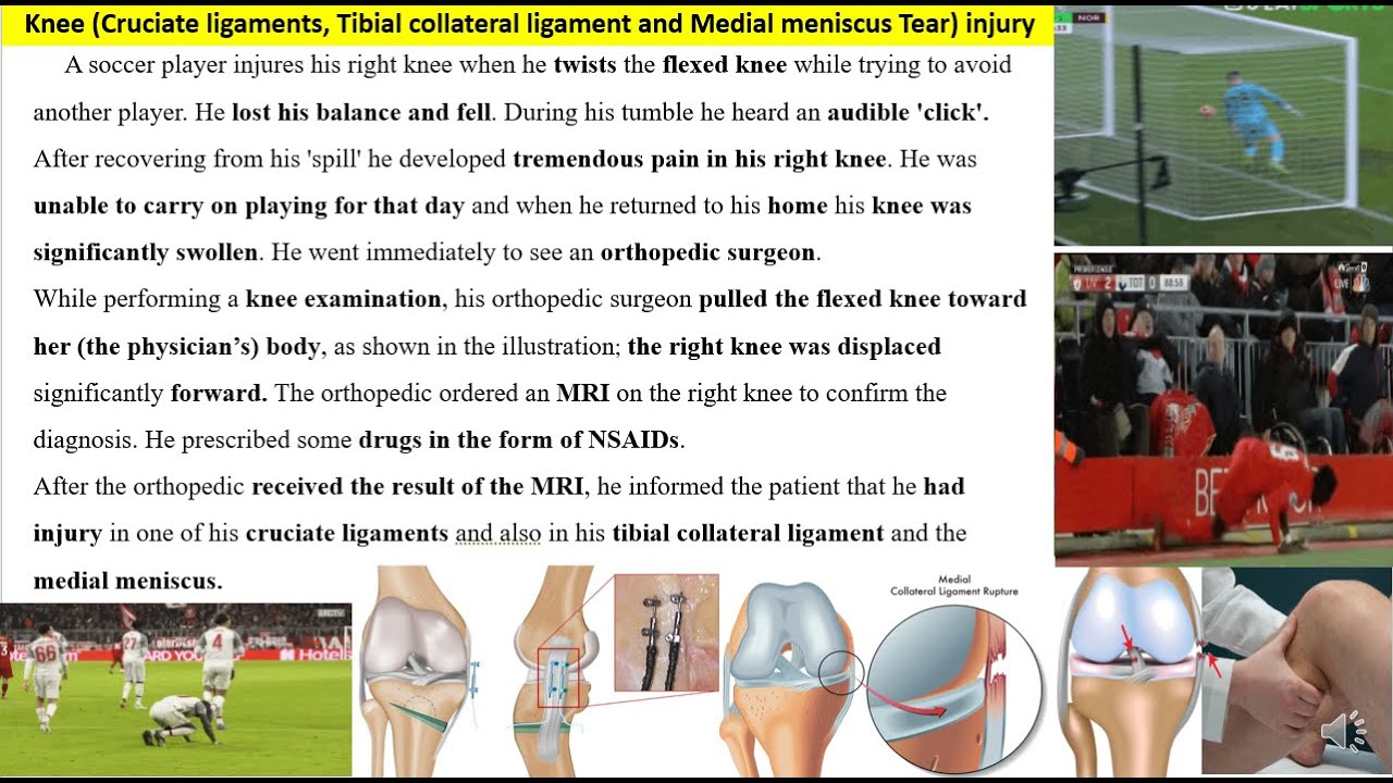 CBL: Semester- 3, Case of knee injury, Medial meniscus & Cruciate ...