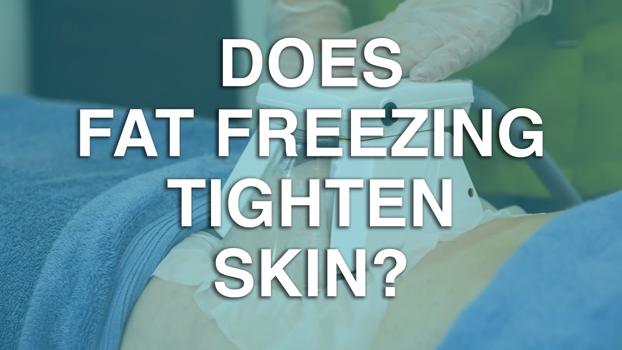 Does fat freezing tighten skin? | The Body Clinic | Fat Freezing FAQ ️ ...