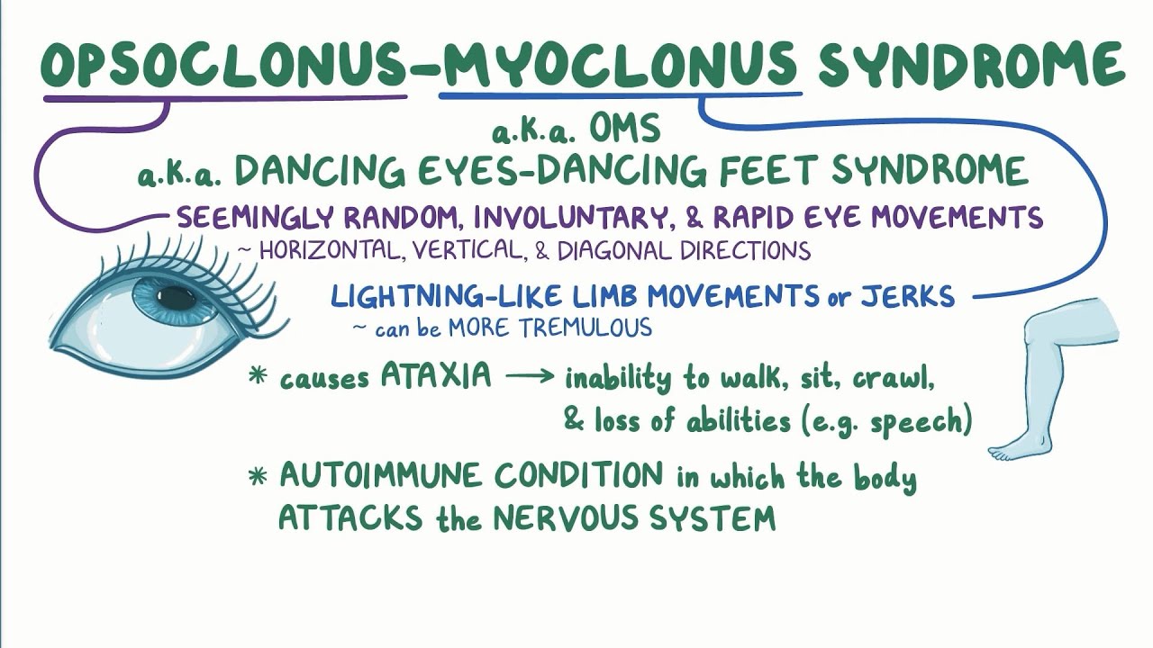 Opsoclonus Myoclonus Syndrome: Symptoms, Challenges, and Treatment ...