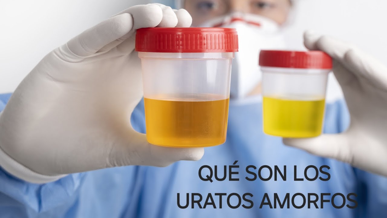 🔥 QUÉ SON LOS URATOS AMORFOS 🥹 - YouTube