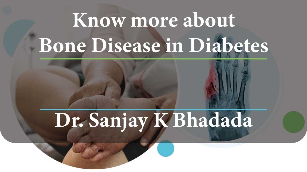 Know more about Bone Disease in Diabetes - YouTube