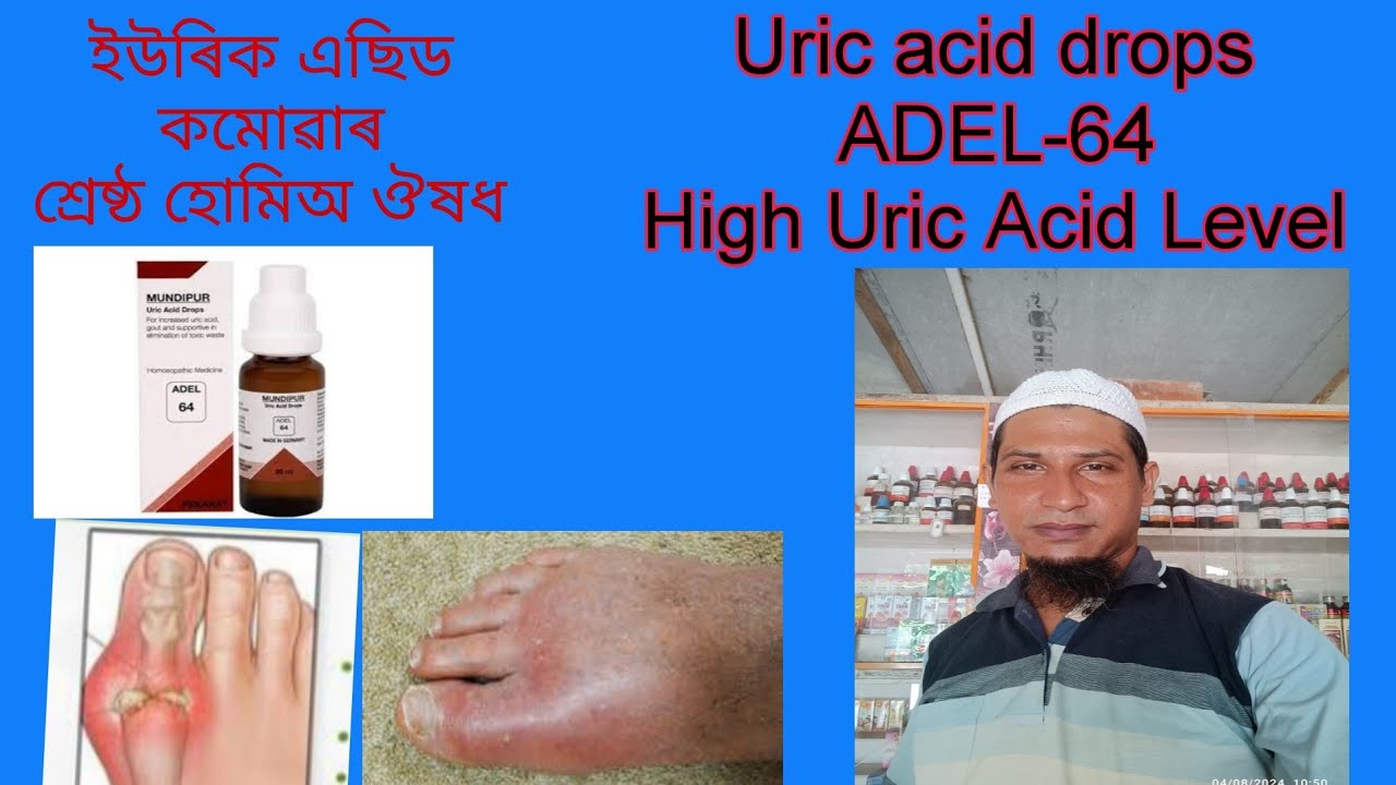 Uric acid drops #uric_acid #uricacidtreatment - YouTube