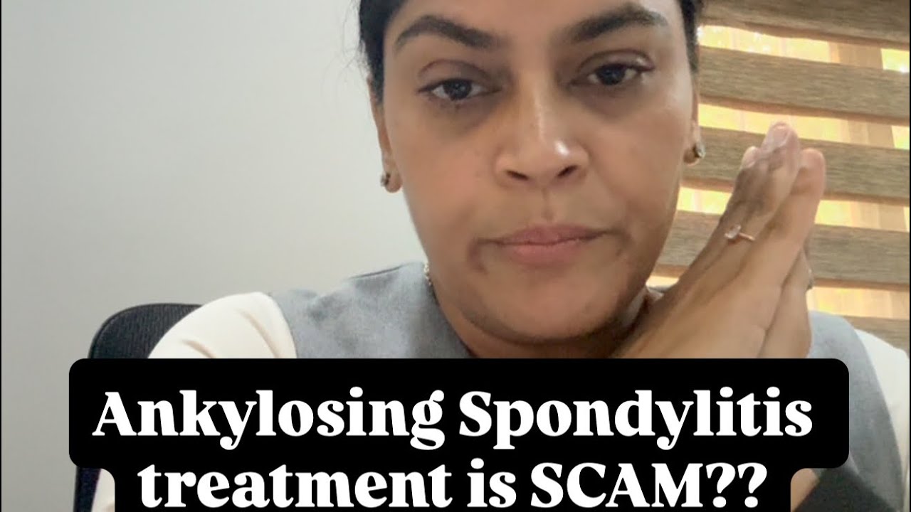 Dr Nitu Verma (PT) is going live! Ankylosis spondylitis - YouTube