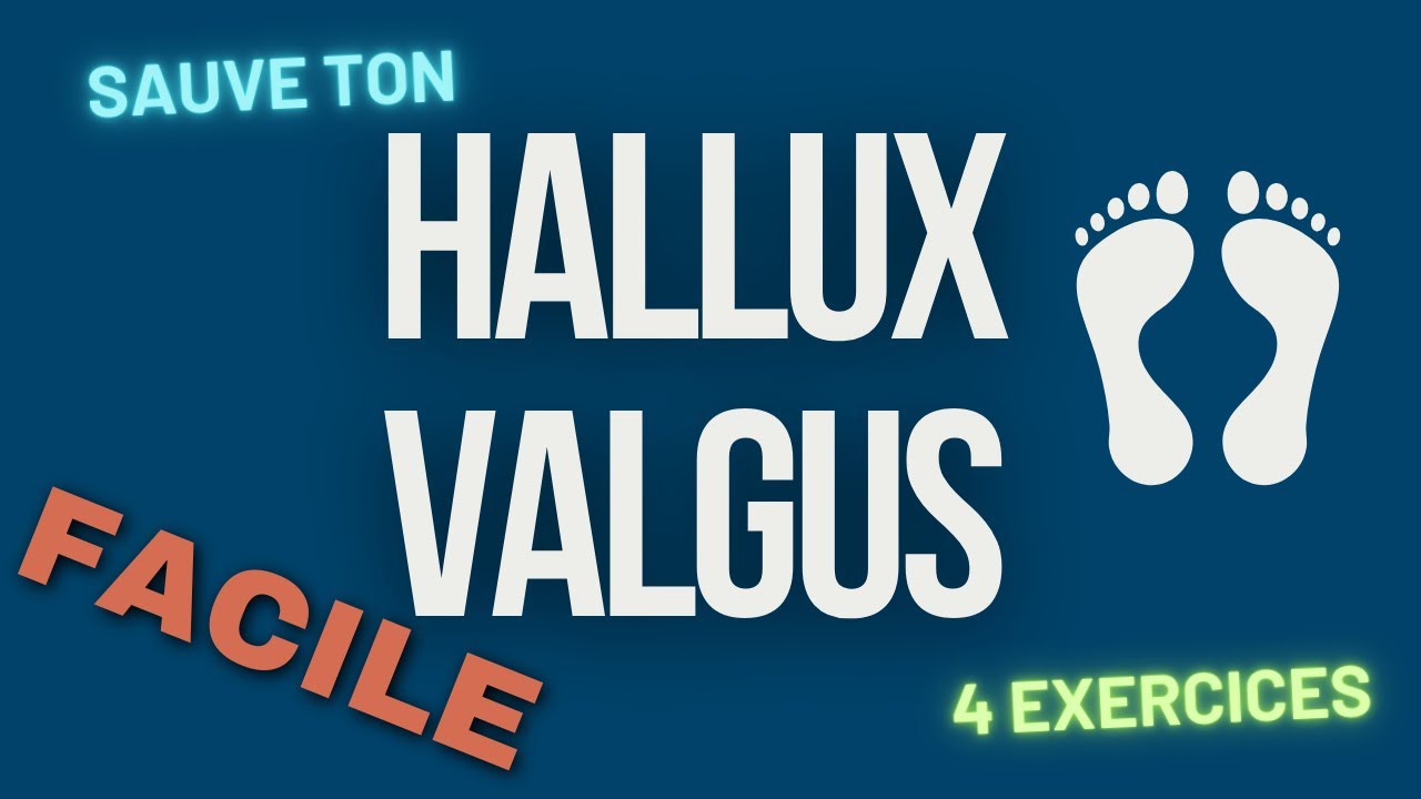 AMELIORE ton HALLUX VALGUS avec ces 4 exercices - YouTube