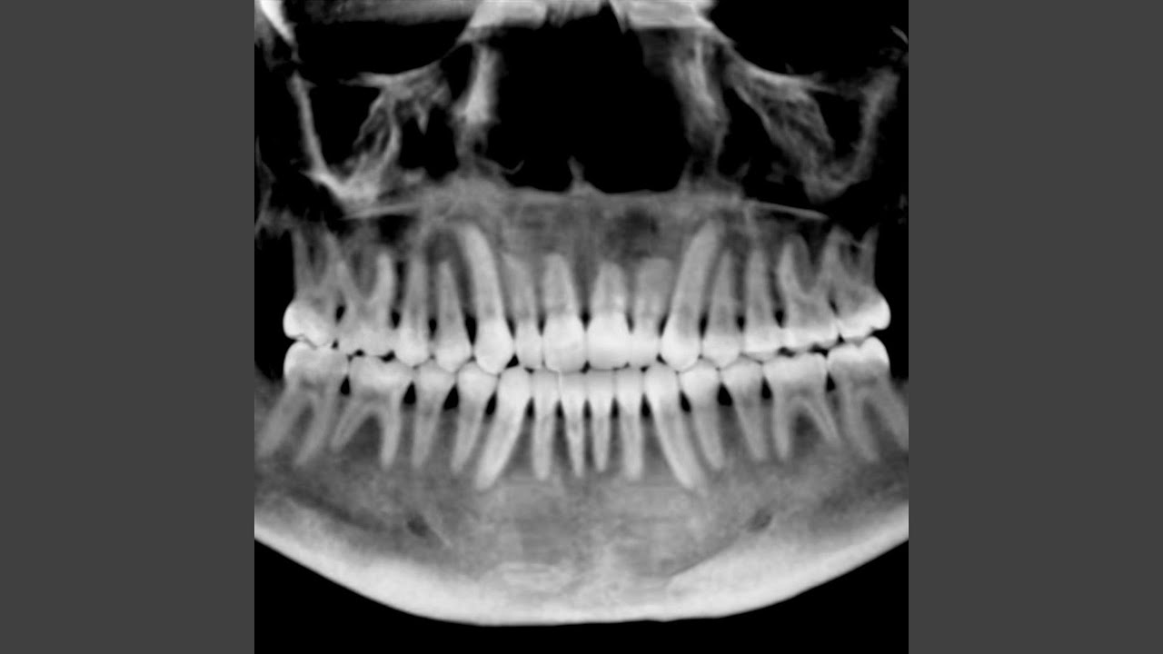 Enter The Dextroverse - YouTube