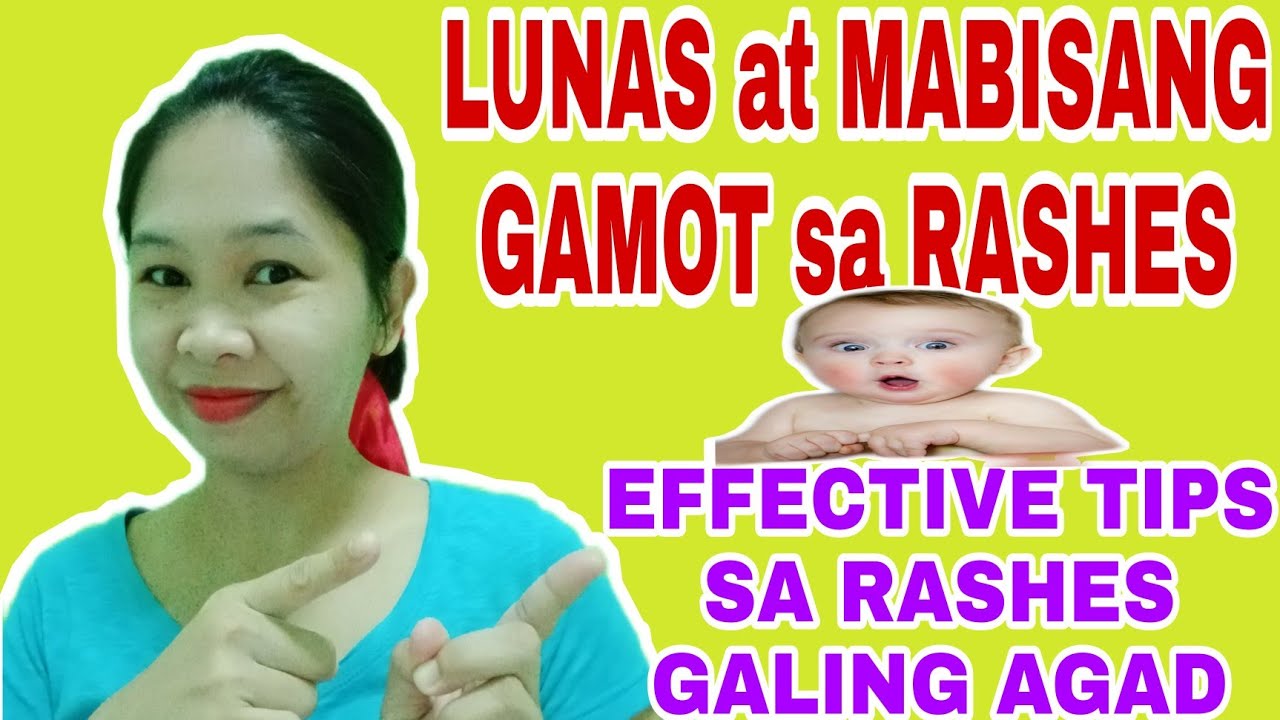 LUNAS AT MABISANG GAMOT SA RASHES NG BABY | Mommy neth - YouTube