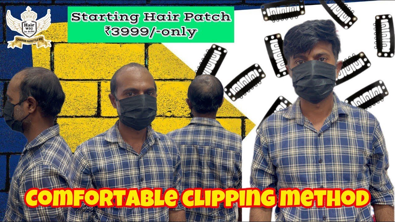 Simple Look in clipping method Hair Wig | Non-Surgical Hair ...