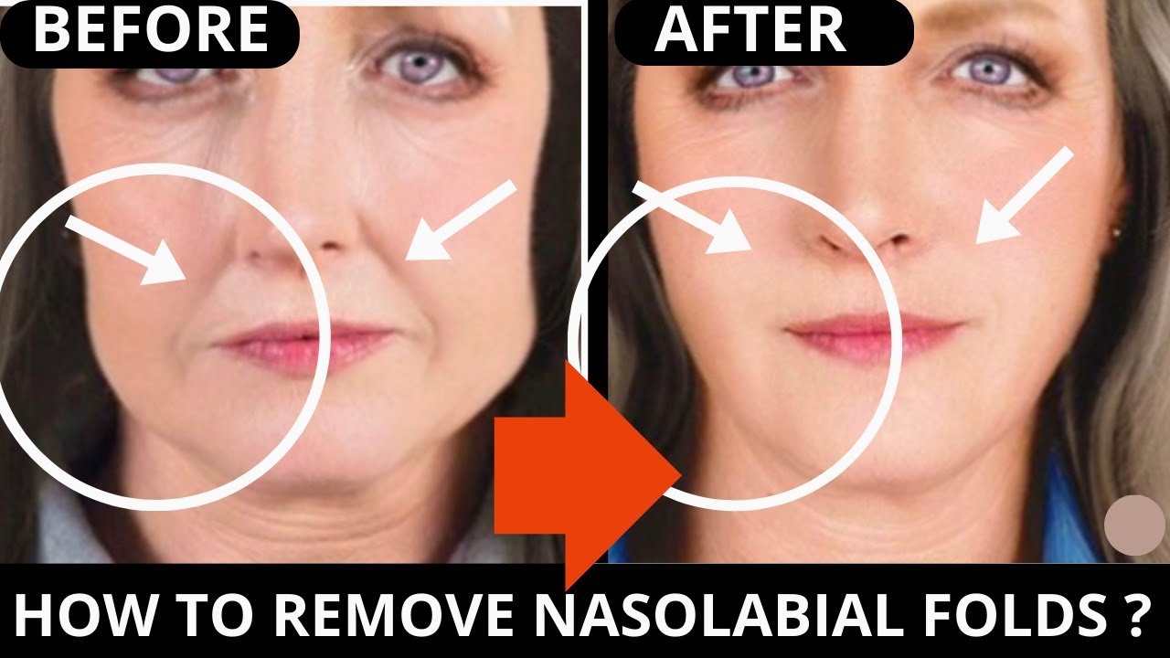 FACE EXERCISES TO REDUCE SMILE LINES ( LAUGH LIENS) SAGGY SKIN, JOWLS ...