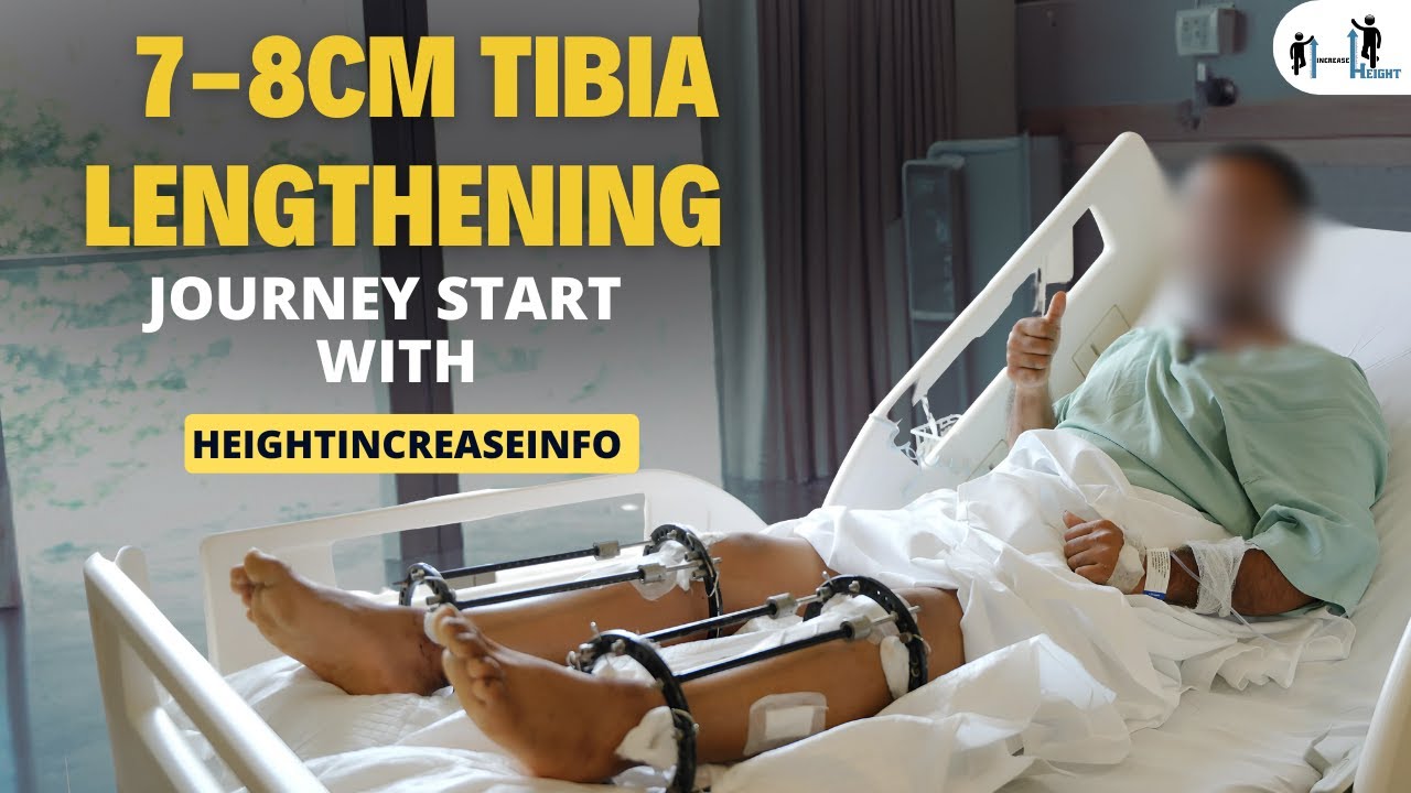 Limb lengthening journey begin | Tibia Limb Lengthening surgery in ...