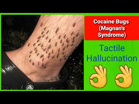 Cocaine Bugs || Magnan's Syndrome - YouTube
