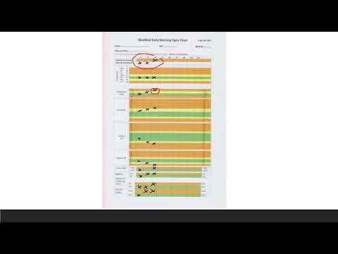 MEOWS Chart and SBAR for Labour Room Practice - YouTube