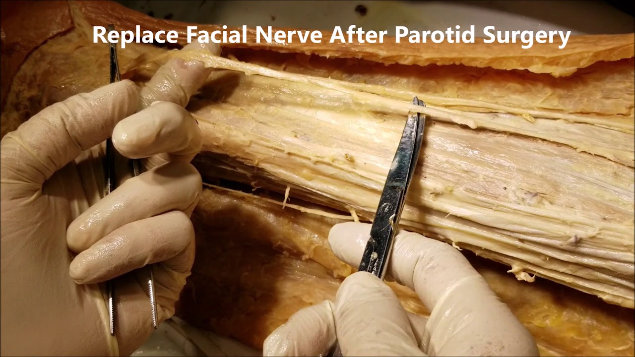 LEG – SURAL SUPF FIBULAR FEMORAL CUTANEOUS Nerves SSV and Clinicals ...