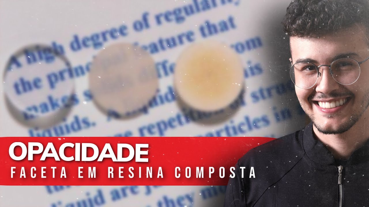 Opacidade de Resinas Compostas - Escolha para Facetas de Resina ...