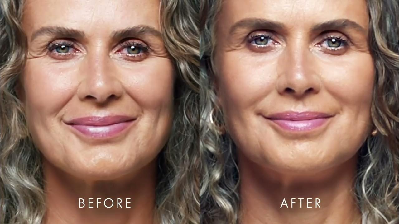 RHA Before and Afters - YouTube