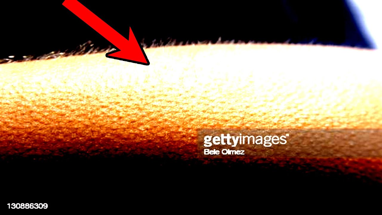 GETTING A GOOSE BUMP *AMAZING*. - YouTube