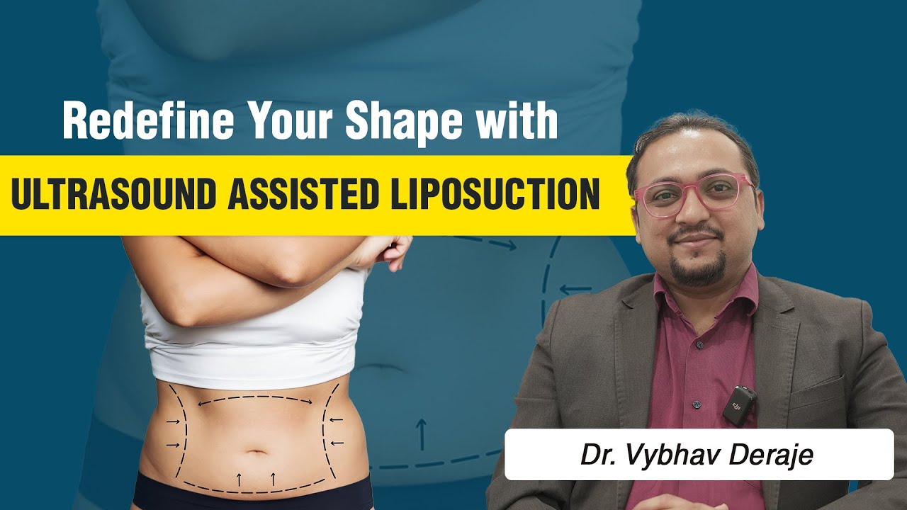 What is Ultrasound assisted Liposuction And what are it’s advantages ...