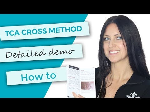 TCA CROSS | Detailed Information | Application