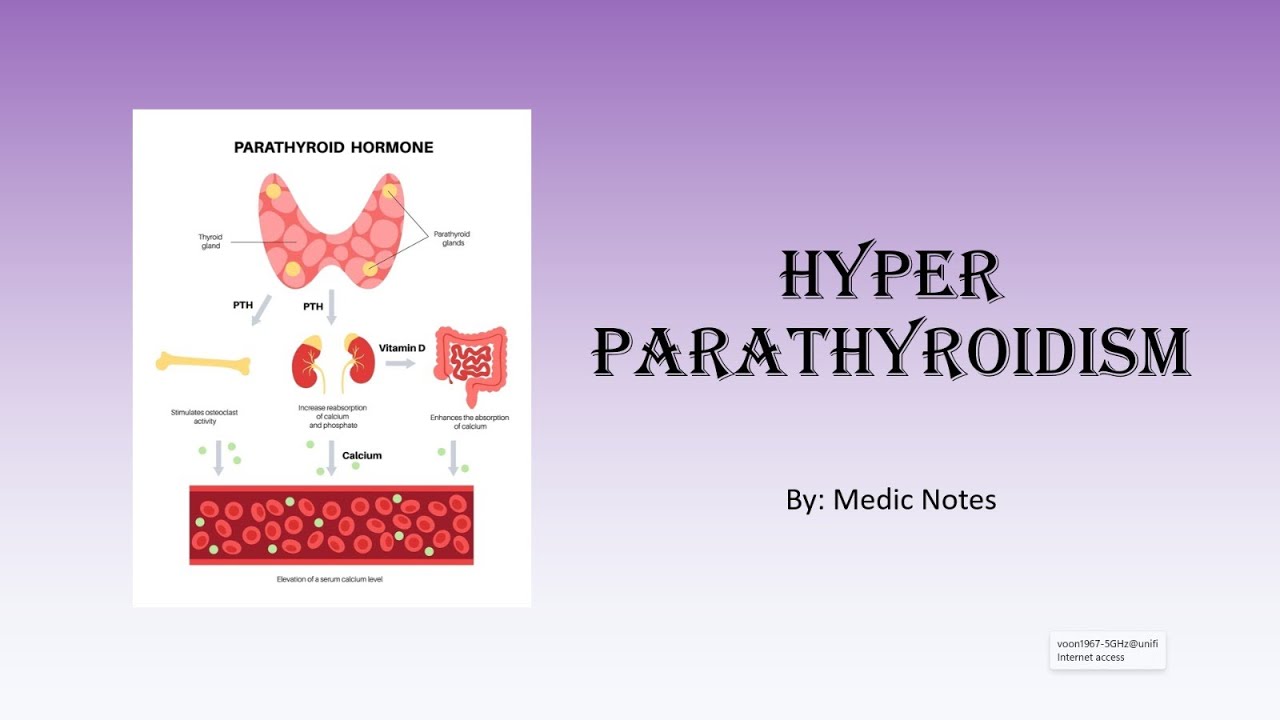 Hyperparathyroidism - causes, classification primary/secondary/tertiary ...