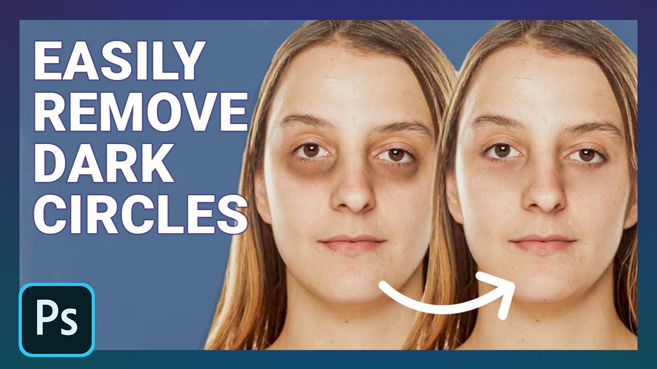 INSTANT EYE RETOUCHING How To Remove Dark Circles Under Eyes In Photoshop YouTube instant-eye-retouching-how-to-remove-dark-circles-under-eyes-in-photoshop-youtube
