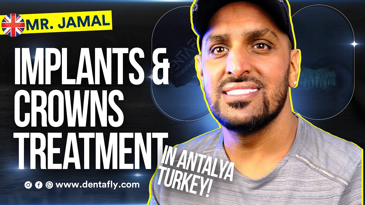 Implants & Crown Treatment at Dentafly Antalya | Jamal's Smile Makeover ...