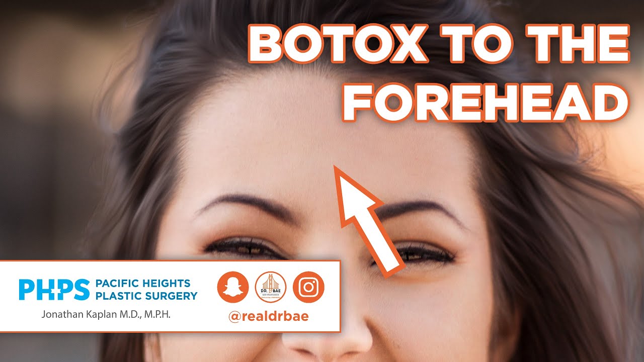 *BOTOX* Injection to the Forehead | Pacific Heights Plastic Surgery ...