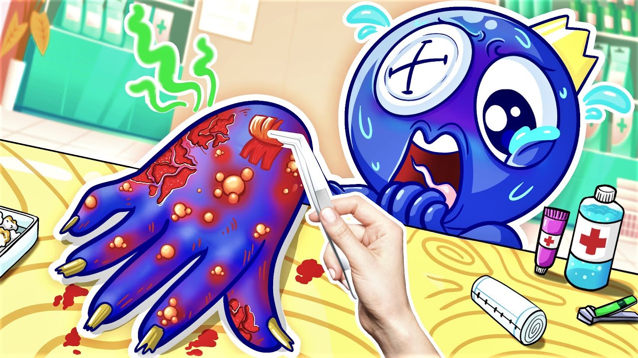 SOS! Blue's hand burned | Rainbow Friends Animation - YouTube