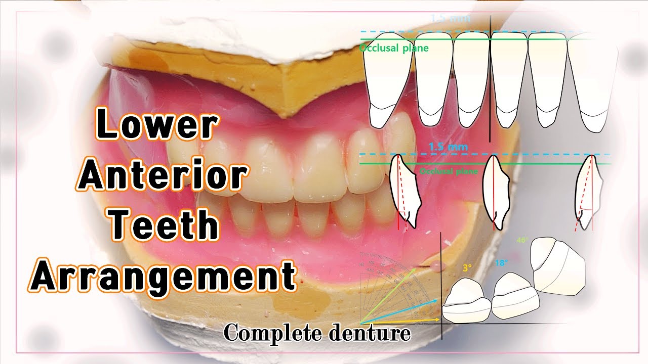 하악 전치부 배열 Lower Anterior Teeth Arrangement [4K] - YouTube