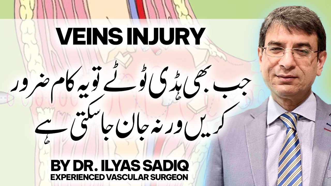 Agar Haddi Toot Jaye To Kia Ilaj Karwana Chahiye? Vascular Injury | Dr ...